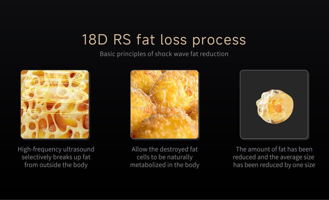 22D HIFU Machine – Advanced HIFU for Skin Lifting & Tightening